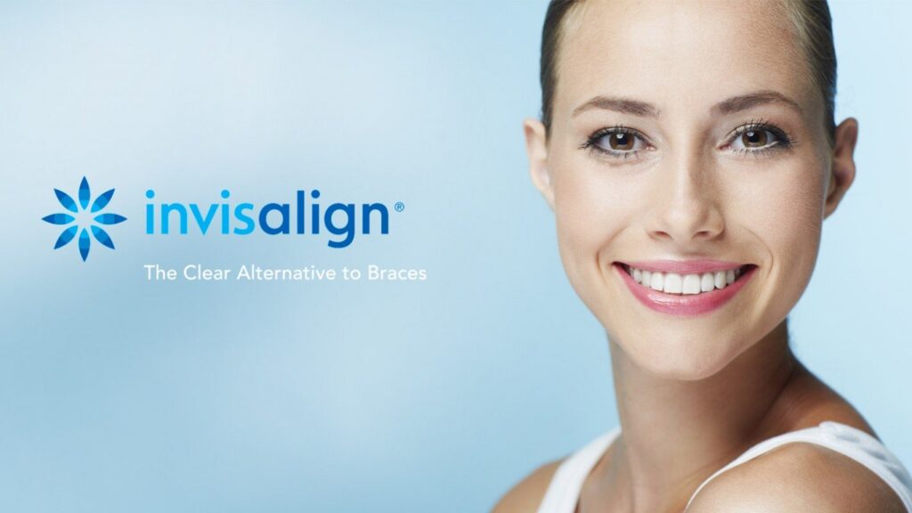 How to Know If You're a Candidate for Invisalign - First impression